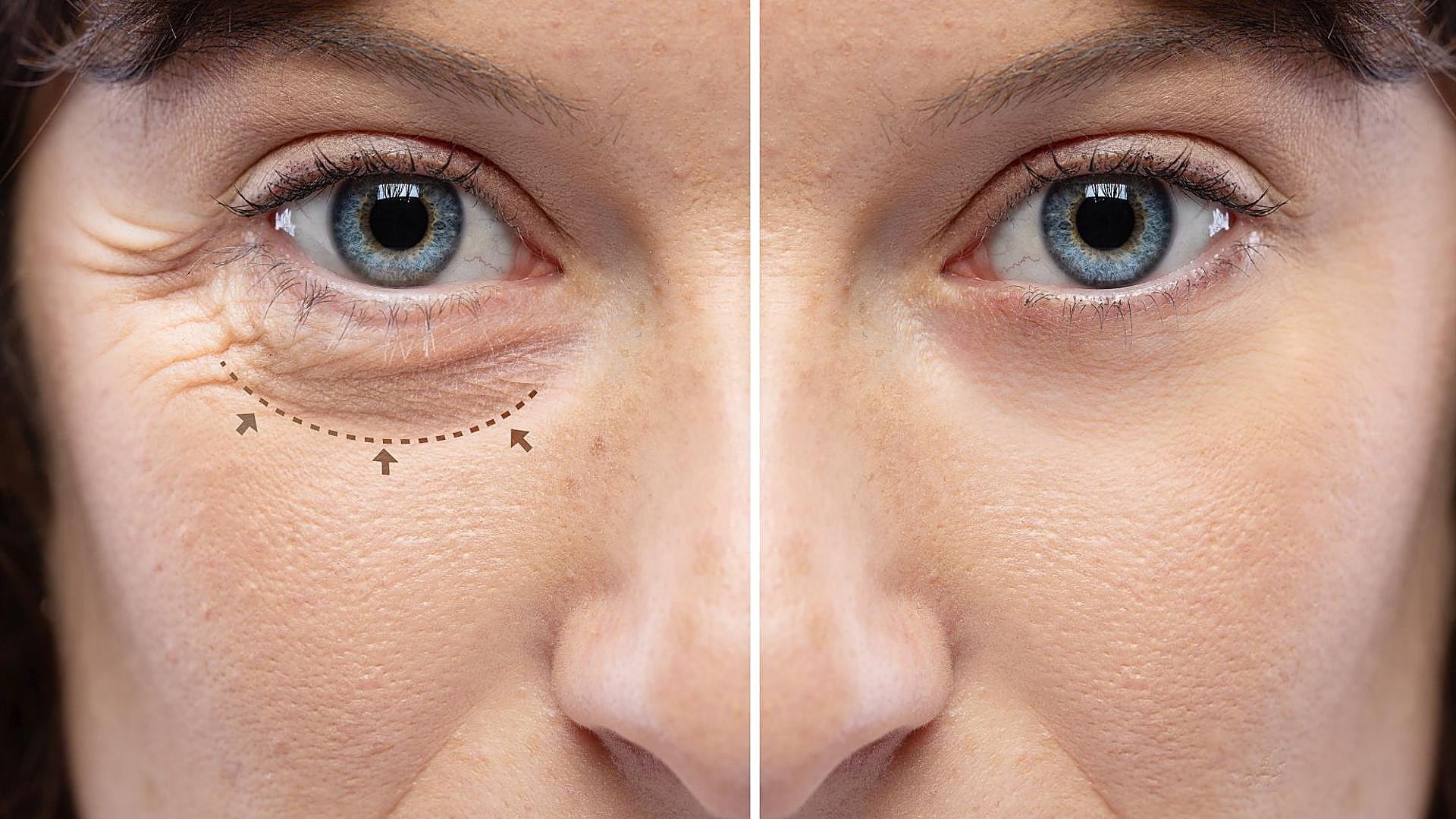 «Una mirada rejuvenecida y descansada influye directamente en la ...