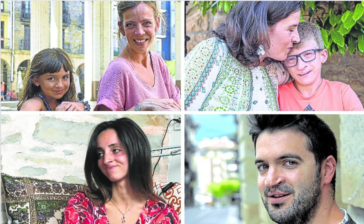 En la piel de mis labios leporinos | El Correo