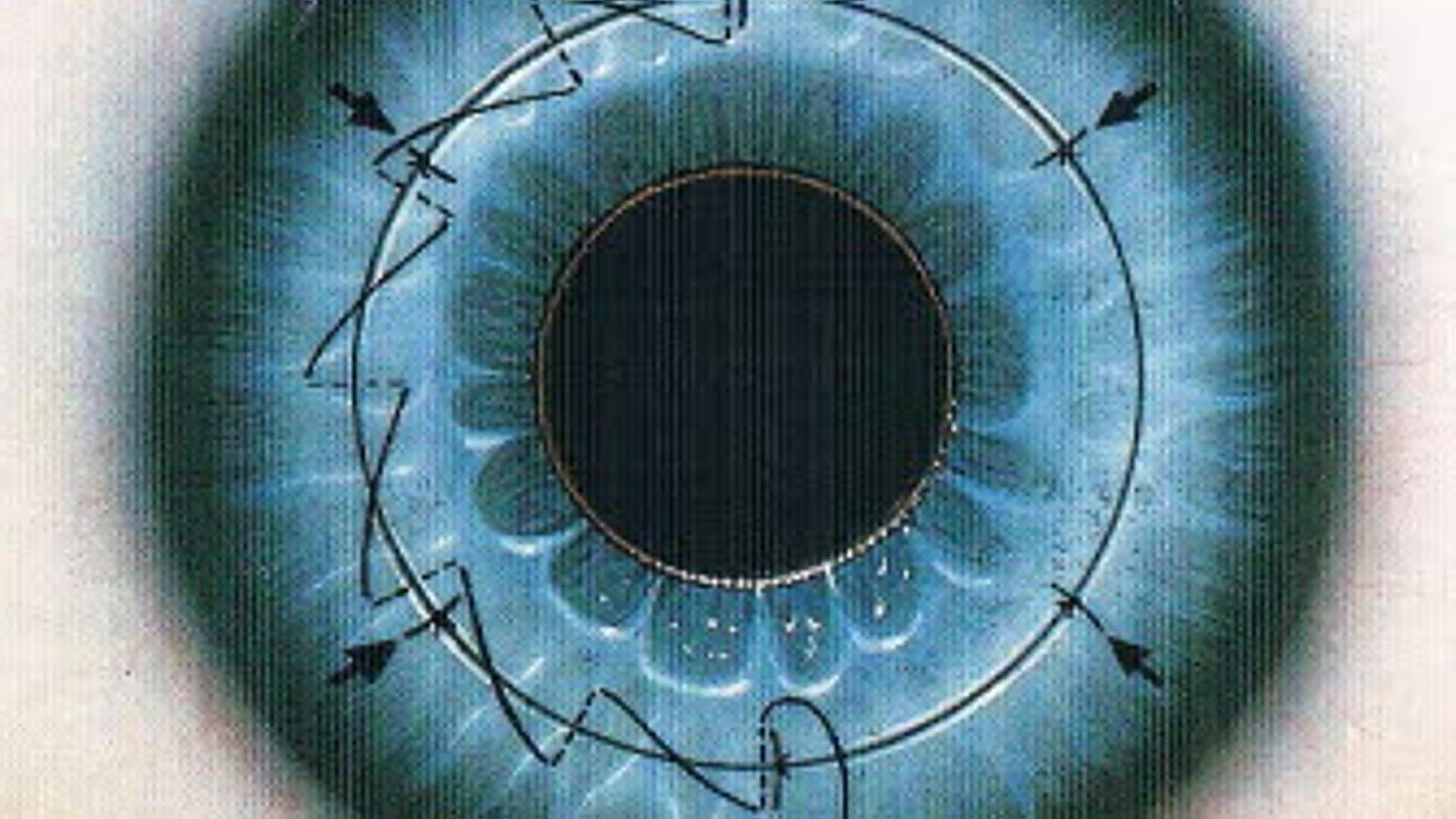 Piden colaboración para encontrar un ojo de cristal extraviado en ...