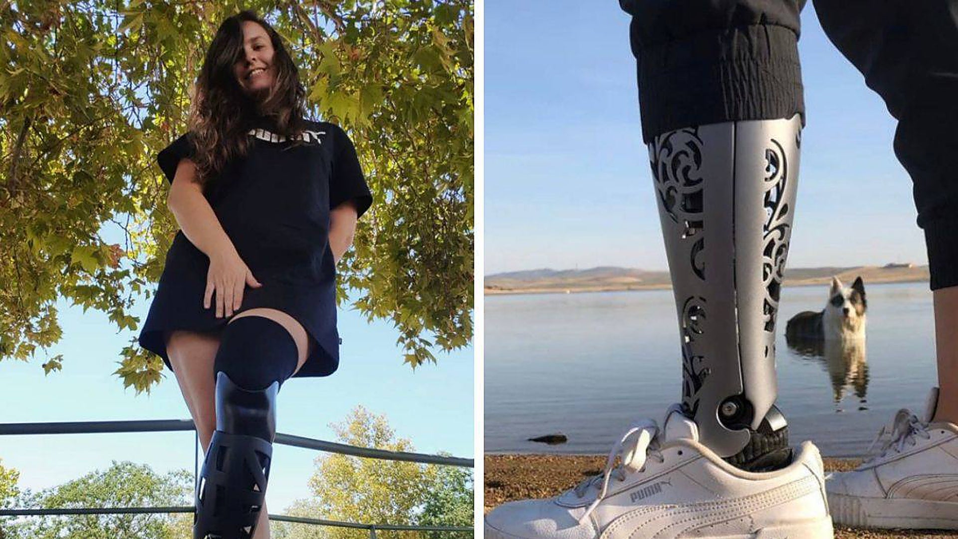 Cristina Magro: «Vamos a desfilar como modelos para dar visibilidad a las personas amputadas» | Hoy