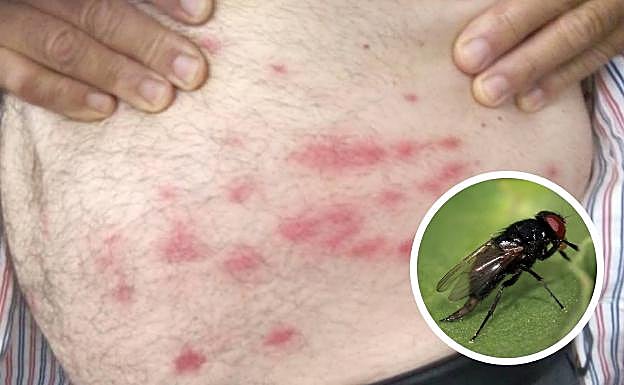 Mosca Negra | Así afecta a tu salud su mordedura: sangre y picor ...
