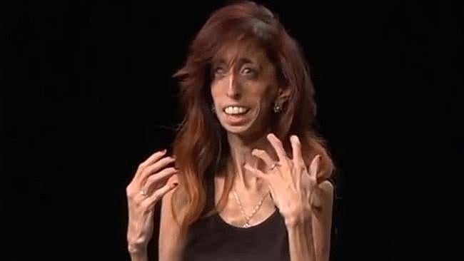 El discurso emotivo de la 'mujer más fea del mundo' | Ideal