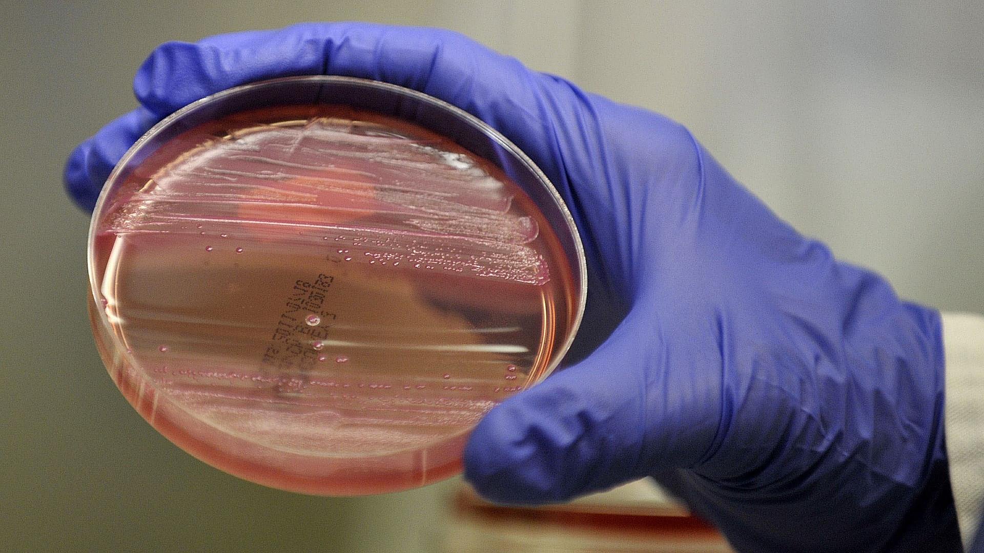 Laura Botello Morte: Nuevos antibióticos: tres buenas noticias en la ...