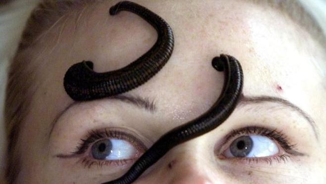 Leeches make a comeback | Sur in English